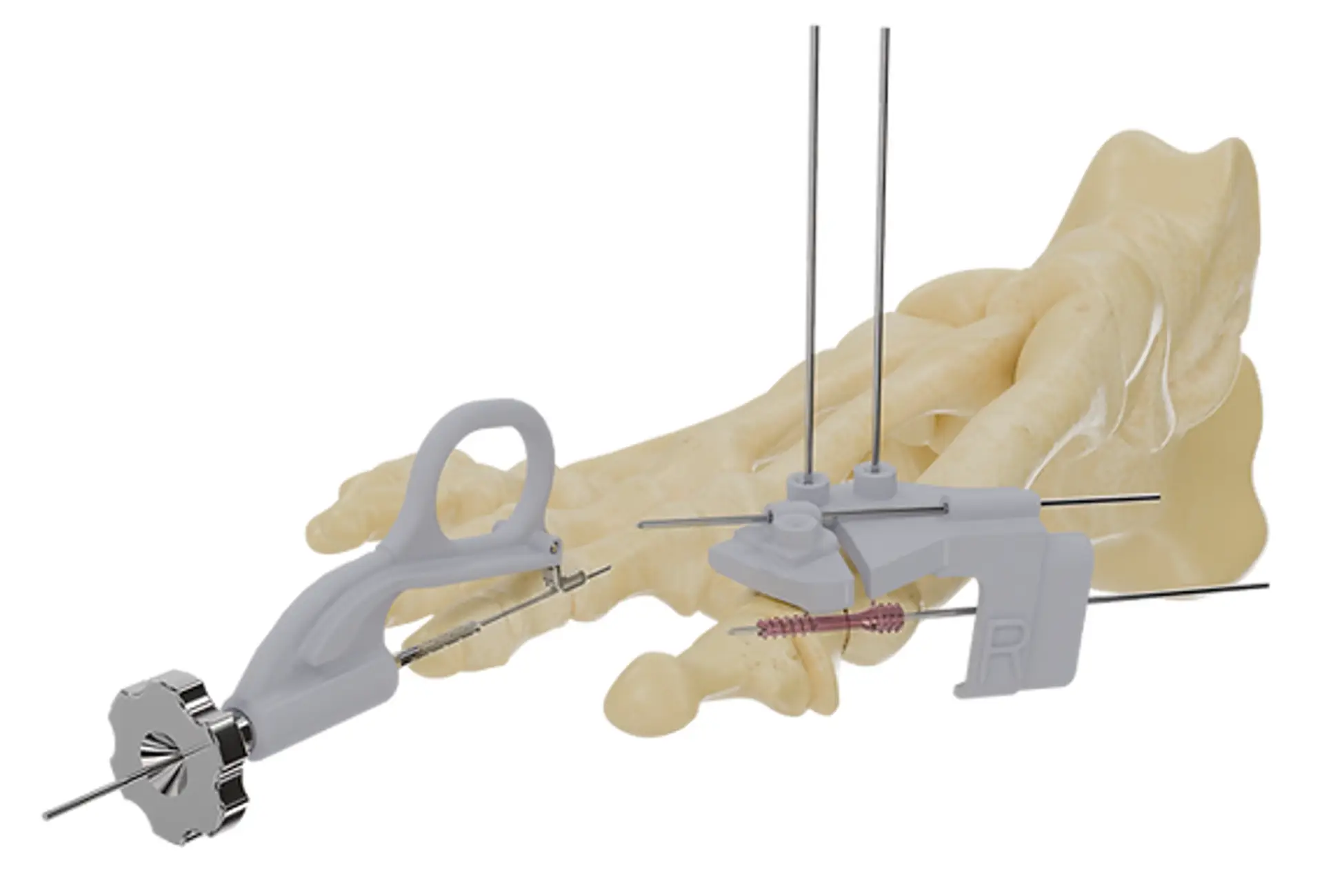 Forma Medical is Revolutionizing Orthopedic Surgery - Ben Franklin ...